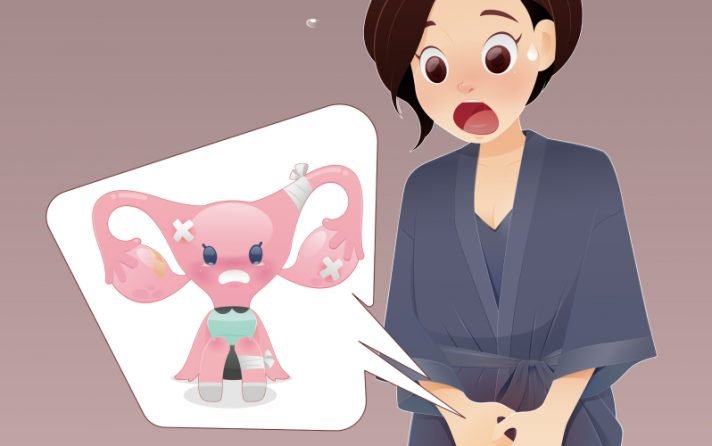 Miyom Nedir? - Belirtileri Nelerdir? - Ameliyatı Nasıl Olur?