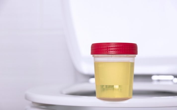 Hamilelikte İdrar Rengi Nasıl Olmalıdır? - Dr. Sait Halil